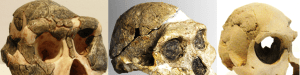 The supraorbital torus in hominin – Nutcracker Man