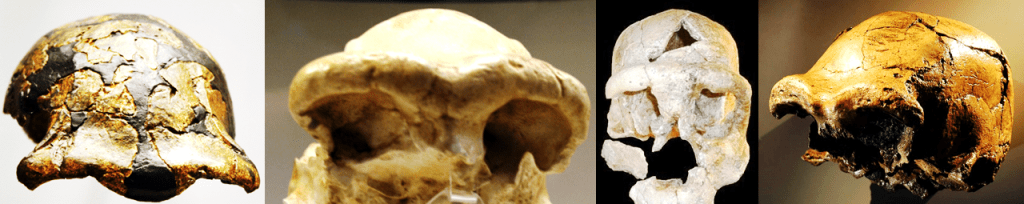 The supraorbital torus in hominin – Nutcracker Man